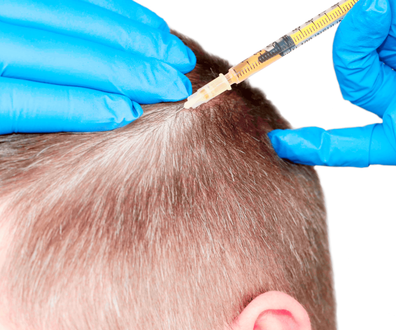 Stem cell injections in Geneva from 1900 CHF - Clinique Adonis